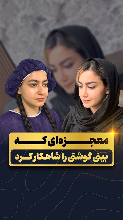 ‎دکتر اکبر اعتمادی جراحی بینی‎ ‎بینی همراه با خط کانتور😍 تغییر