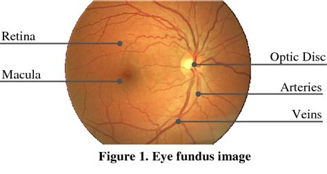 Ocular Fundus Labeled