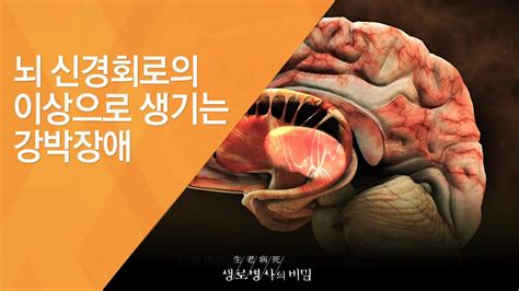 뇌 신경회로의 이상으로 생기는 강박장애 20121229442회 방송현대인의 마음병 불안장애 Youtube