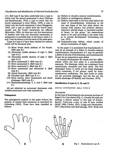 Classification And Identification Of Inherited Brachydactylies Pmc