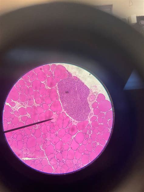 Thyroid And Parathyroid Glands Microscope Image