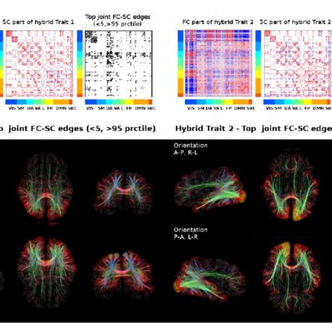 Pdf Mapping Hybrid Functional‐structural Connectivity Traits In The
