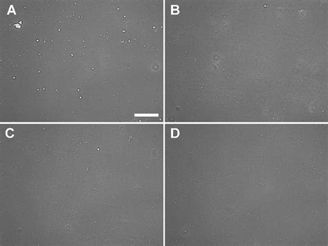 Figure 5 From Rapid Isolation And Purification Of Mitochondria For Transplantation Using Tissue