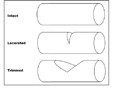 Figure 1 From Effect Of Triggering And Entrapment On Tendon Gliding