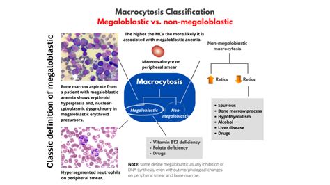 Classification Of Macrocytosis • The Blood Project
