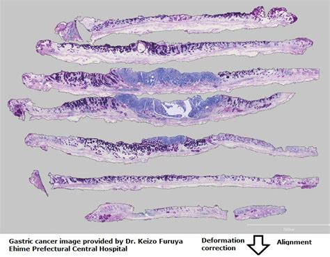 Pathological Tissue 3d Reconstruction Observation Software