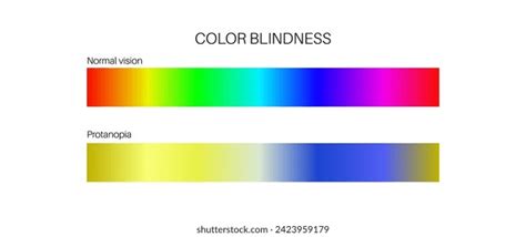 Protanopia Vision Color Blindness Infographic Human Stock Vector Royalty Free 2423959179