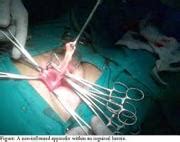 Appendix Assignment Point