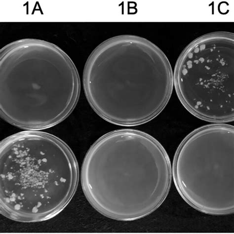 Sexual Agglutination In Tetrad Spore Clones A Result Of Sexual Download Scientific Diagram