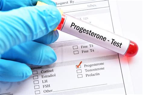 Progesterone Hormone Test Stock Image Image Of Medicine 116270521