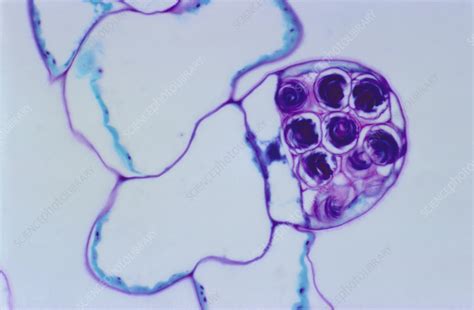 Fern Male Sex Organ Light Micrograph Stock Image C Science Photo Library