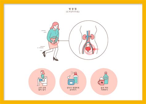 방광암의 대표적인 증상과 수술법 건강검진정보
