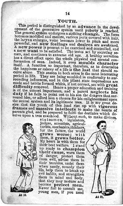 The Sexual System And Its Derangements By Dr E C Abbey 1882 Youth And Manhood At The