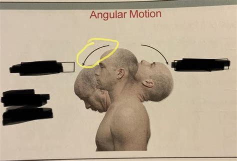 Types Of Movement Intro To Muscles Exam Flashcards Quizlet