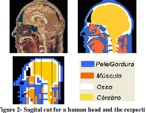 Figure 2 From Sar Calculation Using Fdtd Simulations Semantic Scholar