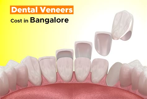 Dental Crown Types And Cost In India
