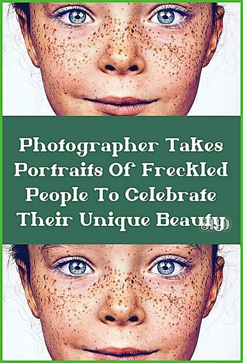 Photographer Takes Portraits Of Freckled People To Celebrate Their