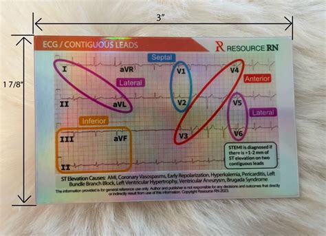 Holographic Sticker Ekg Stemi Reference Tool Badge Card Etsy