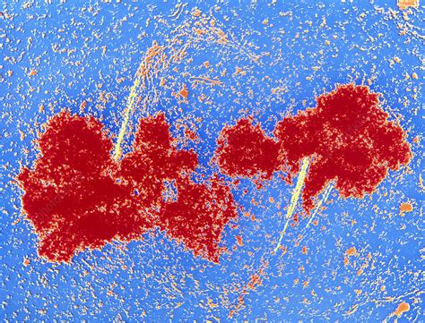 Col Tem Of Metaphase Cell Division Of A Hela Cell Stock Image P672 0041 Science Photo Library