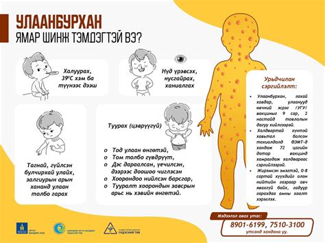 Хархорины 📍📍📍 УЛААНБУРХАН ЯМАР ШИНЖ ТЭМДЭГТЭЙ ВЭ • Халуурах 39С ба