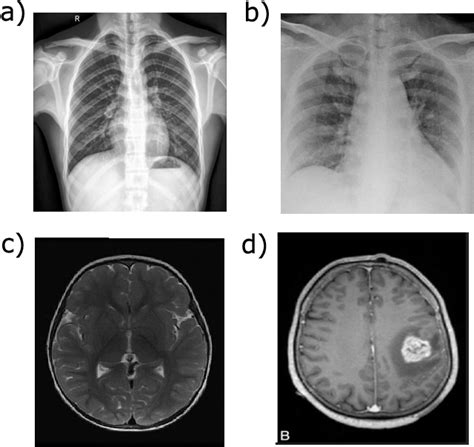 Autoqml Automatic Generation And Training Of Robust Quantum Inspired Classifiers By Using