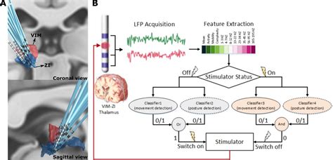 Closed Loop Deep Brain Stimulation For Essential Tremor Based On