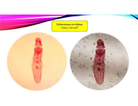 دانلود جزوه عملی کرم پهن و بیماریها رشته دامپزشکی شهر جزوه