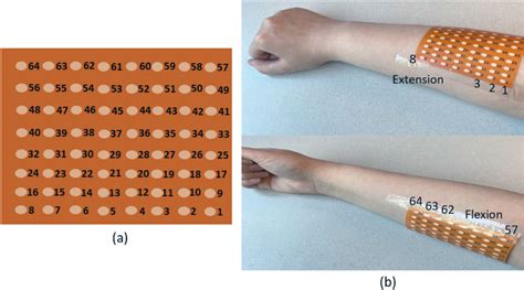 Representation Of The Hd Semg Acquisition Setup³¹ A The Download Scientific Diagram