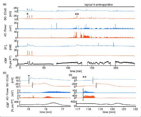 4 Ap Induces Recurrent Seizures Under Urethane Anesthesia A Download Scientific Diagram
