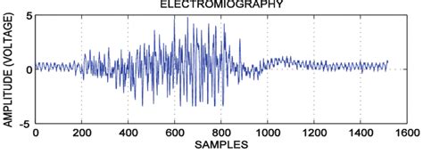 Myoelectric Signal Produced By The Full Fist Download Scientific Diagram