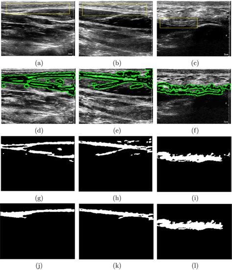 Segmentation Results Of A Fully Automatic Localizing Region Based Download Scientific Diagram