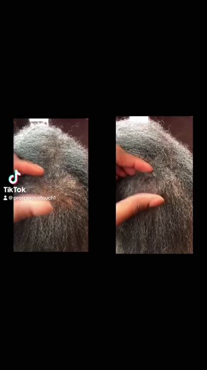 Laquanda Bell Brown On Linkedin Fyp Viral Instagood Hairgrowth