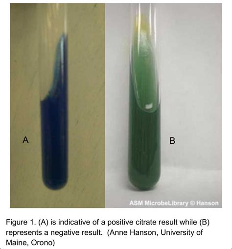 Solved Citrate Test Purpose The Citrate Test Screens A Bacterial Isolate Course Hero