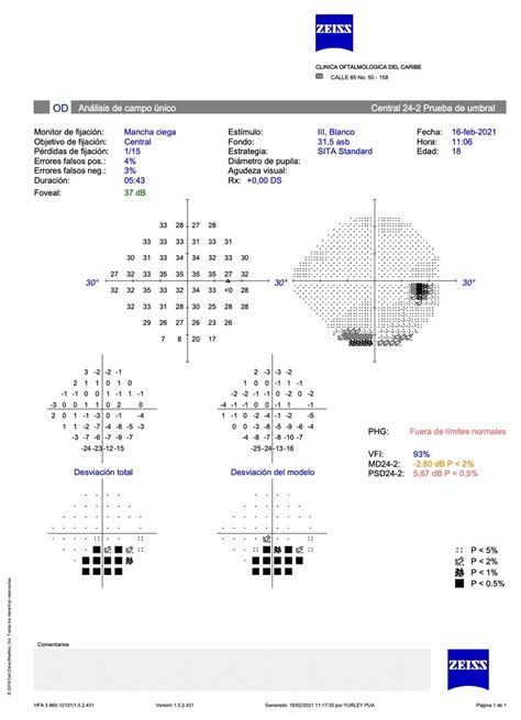 Computerized Visual Field Sita Swedish Interactive Thresholding