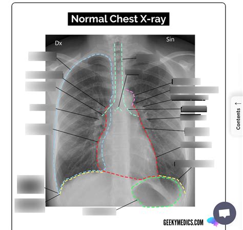 Diagram Of Normal Cxr Quizlet