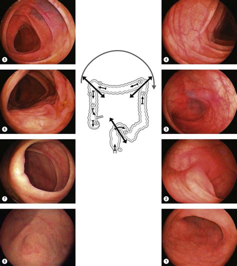 Preparation For Endoscopy Abdominal Key