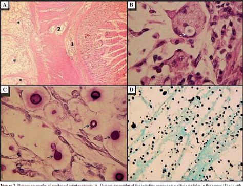 Figure 1 From Peritoneal Cryptococcosis In A Dog Semantic Scholar