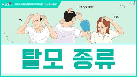 탈모 종류와 원인 두피 건강 챙기세요 Youtube