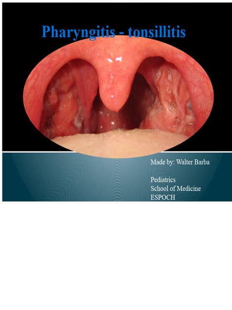 Pharyngitis Tonsillitis Pdf Animal Diseases Organisms