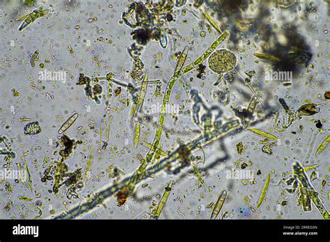 Fungal And Fungi Hyphae Under The Microscope In The Soil And Compost