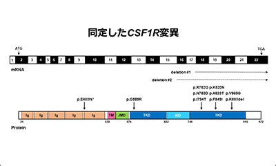 Novel Partial Deletions Frameshift And Missense Mutations Of CSF1R In Patents With CSF1R