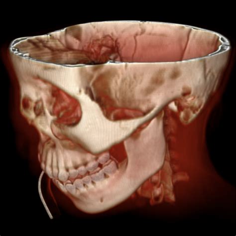 Cinematic Volume Rendering In Your Web Browser Volview And Vtk Js