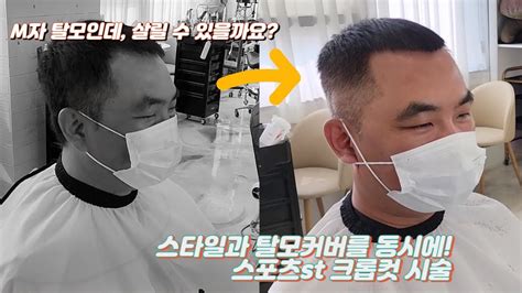 M자 탈모 크롭컷 스타일로 풍성함 177 강조하며 자르기 엠자탈모 자르는 방법 종결 Youtube