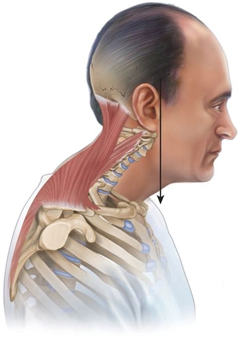 Шейный лордоз лечебная гимнастика