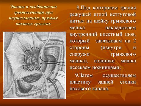 Топографо анатомические предпосылки возникновения грыж различной локализации презентация онлайн