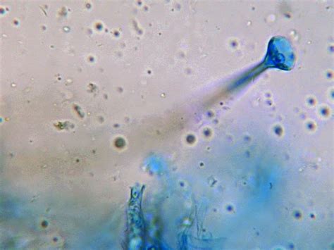 Fun With Microbiology Whats Buggin You Apophysomyces Elegans