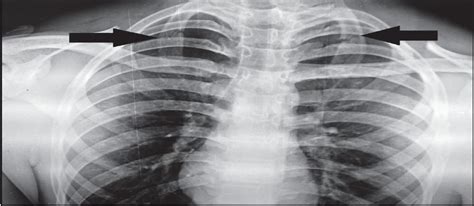 Medical Journal Of Dr D Y Patil Vidyapeeth