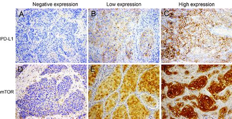 Immunohistochemical Staining Of The Representative Cases For Pd L1 Download Scientific Diagram