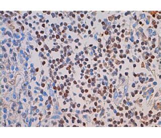 RUNX Antibody A Immunohistochemistry Image