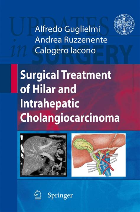 Surgical Treatment Of Hilar And Intrahepatic Cholangiocarcinoma Guglielmi Alfredo Marchiori